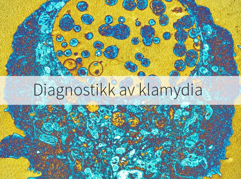 Klamydia og behandling med antibiotika| Selvsjekk